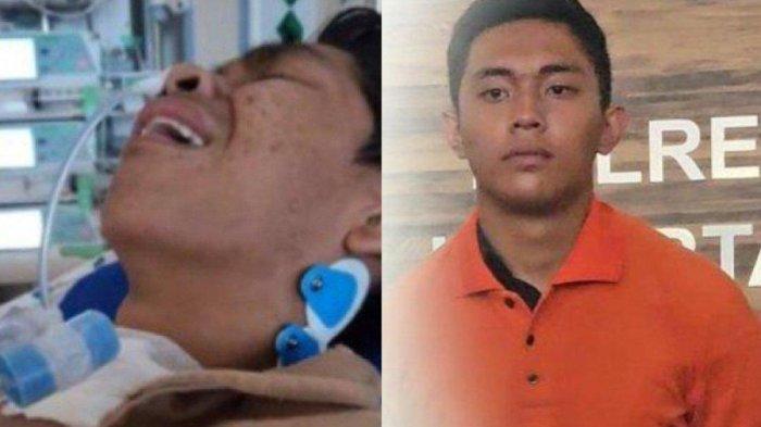 Kondisi David Korban Kekekerasan Mario Dandy Satriyo yang 2 Minggu di ... Kondisi David Korban Kekekerasan Mario Dandy Satriyo yang 2 Minggu di ...