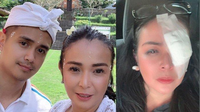 Perban Satu Mata Jennifer Jill Bikin Heboh, Ajun Prawira Sebut Soal ...