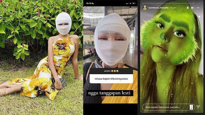 Inilah Wajah Baru Lucinta Luna Pasca Operasi Plastik di Korea Selatan ...