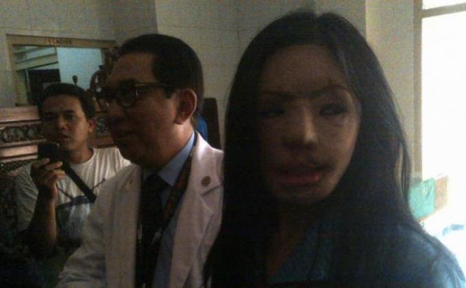 Tujuh Tahun di RS, Lisa "Face Off" Akhirnya Bisa Pulang ...