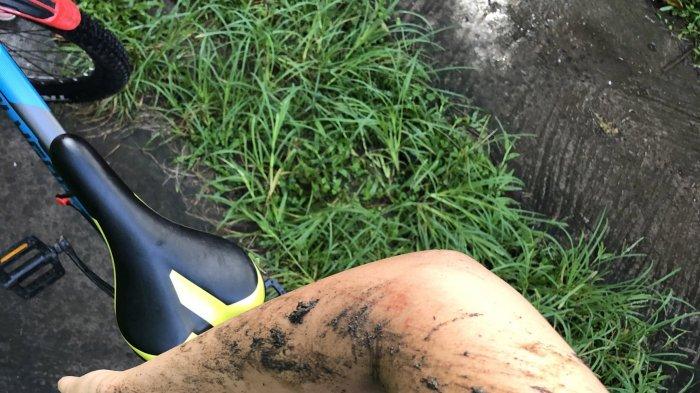 Foto-foto Selebgram Anya Geraldine Terjatuh dari Sepeda - Tribunbanten.com