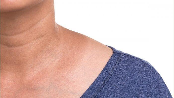 5 Cara Mencerahkan Leher yang Hitam dengan Bahan-bahan Alami, Pakai ...