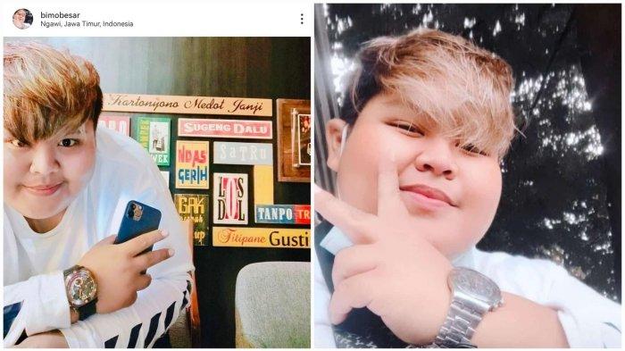 Bimo, Penderita Obesitas yang Viral asal Semarang Meninggal Dunia ...
