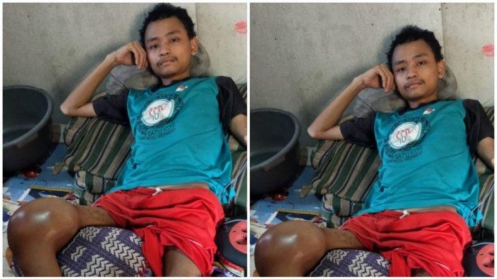 BUTUH BANTUAN Remaja Cilacap Alami Tumor, Hanya Hidup Bersama Nenek dan Adik - Tribunbanyumas.com