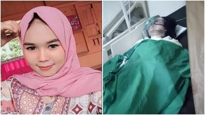 Gadis Muda Dibakar Hidup-hidup Oleh Anggota Polisi, Korban Merintih ...
