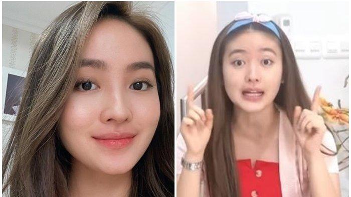 Natasha Wilona Tetiba Curhat ke Boy William soal Perpisahan, Ingat Verrell Bramasta ...