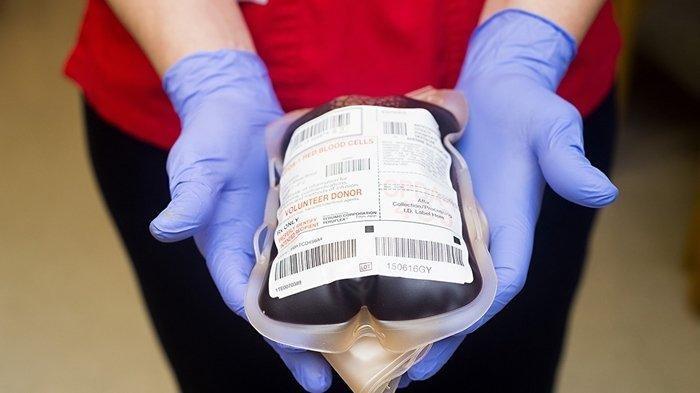 Bisa Picu Kematian, Kenali Hipovolemia Akibat Berkurangnya Volume Darah ...