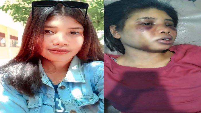 Tangis Ibunda Intan ART di Batam Kena Siksa Majikan, Sedih Lihat Wajah ...