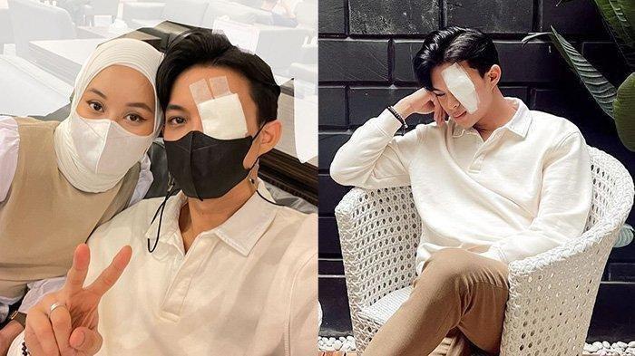 Apa Itu Kalazion? Penyakit Diderita Rey Mbayang Suami Dinda Hauw Hingga ...