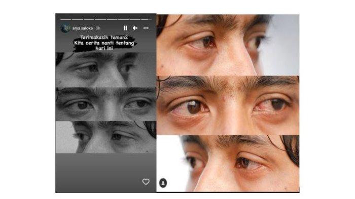 Mata Arya Saloka Saloka Berkaca-kaca Saat Dirinya Ditemukan Kembali di ...