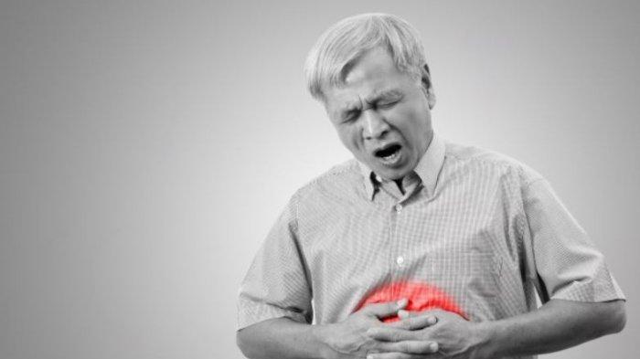 Mengenal Penyebab dan Gejala Kanker Rektum, Waspada bila BAB Tidak ...