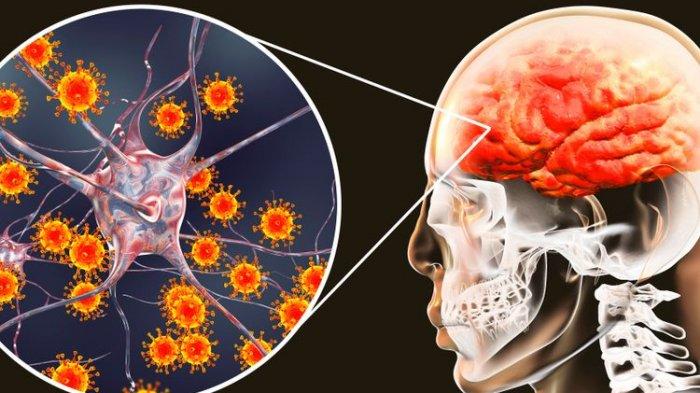 Termasuk Penyakit Langka, Kenali Penyebab dan Gejala Ensefalitis, Anak ...