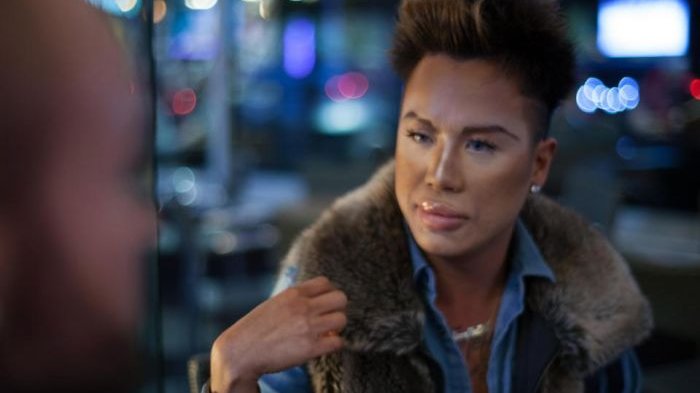 Agar Mirip Kekasih Barbie, Jonny Suntik Botox Bibir Ratusan Kali ...