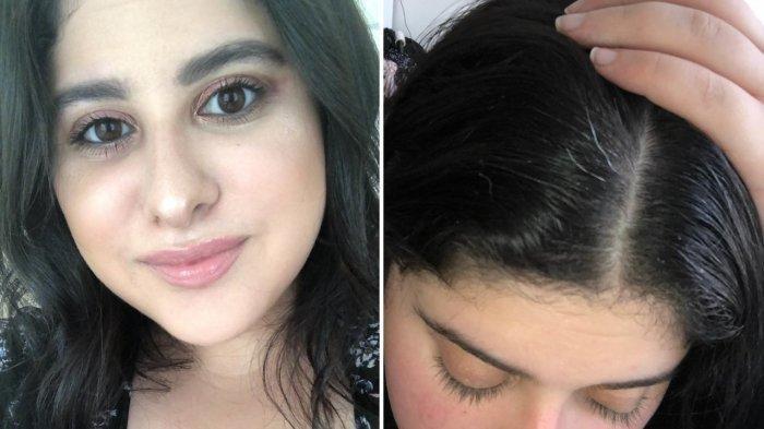 Tak Perlu Pewarna Rambut, 5 Bahan Alami Ini Ampuh Hilangkan Uban, Simak Cara Buatnya ...