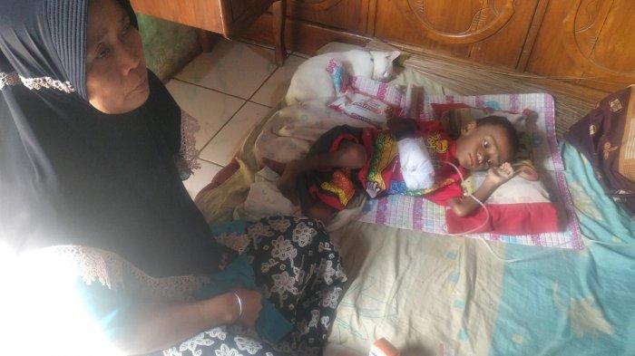 Balita Gizi Buruk di Muaragembong Bekasi Diduga Kuat Tertular Virus HIV Ibunya Sejak Dilahirkan ...