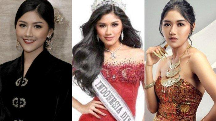 Erina Gudono, Menantu Jokowi, Masuk Bursa Calon Bupati Sleman, Ini Profil, Karier, dan ...