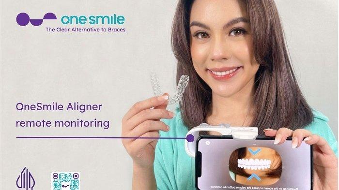 Ini 5 Alasan Harus Memilih OneSmile, Brand Clear Aligners Terbaik di ...