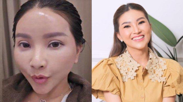 Sarwendah Akui Jadi Lebih Percaya Diri Usai Operasi Plastik Hingga Habiskan Uang Ratusan Juta ...
