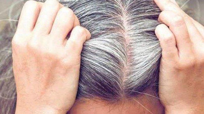 Penyebab Uban di Usia Muda, Awas! Rokok Salah Satunya, Simak Penjelasan dr Saddam Ismail ...