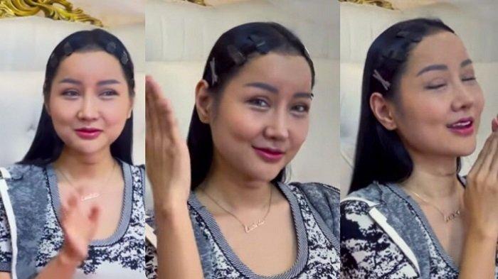 Begini Wajah Baru Lucinta Luna Pasca Operasi Plastik - Posbelitung.co