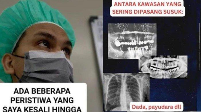 Dokter Syok Temukan Susuk di Tubuh Wanita Lumpuh, Terungkap saat X-Ray, Ada 4 Susuk di Tubuh ...