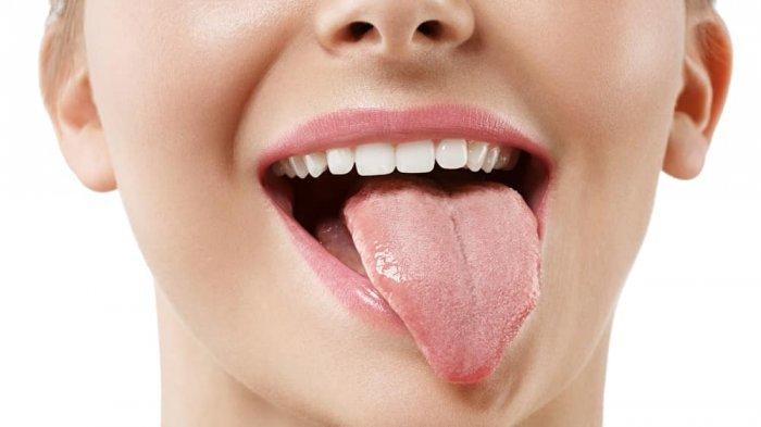 Cek Lidah Anda, Kalau Warnanya Begini Bisa Jadi Itu Pertanda Ada Kanker ...