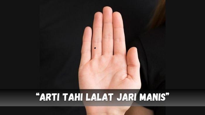 Arti Tahi Lalat di Jari Manis, Waspada Bakal Diselingkuhi Pasangan - Tribunbengkulu.com