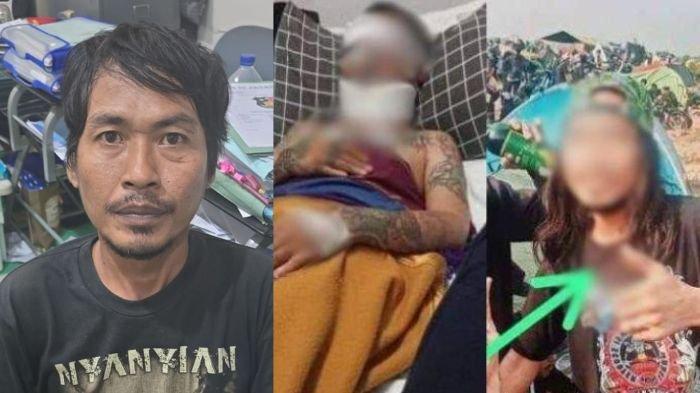 Babak Baru Pengeroyokan Berujung Congkel Mata di Gunung Putri Bogor ...