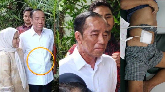 Ngotot Dokter Tifa Bongkar Penyakit Jokowi, Patahkan Ucapan Ajudan Presiden: Harus Dikoreksi ...