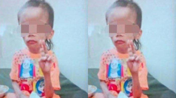 Nasib Bocah 7 Tahun Disiksa Satu Keluarga di Malang, Tangan Dimasukkan Panci Panas-Disekap di ...