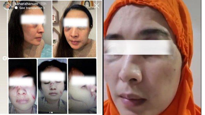 Kasus Istri di Depok Laporkan Suami KDRT Malah Jadi Tersangka, Begini Penjelasan Polisi ...