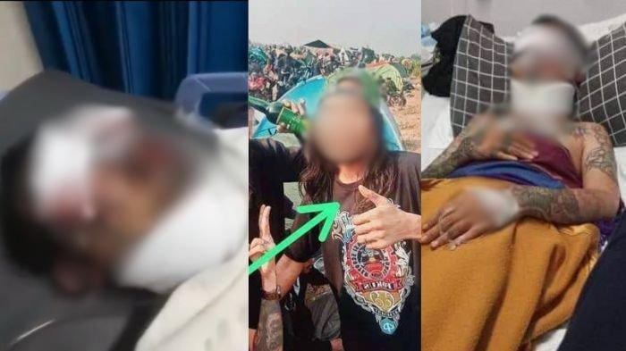 Pemicu Pengeroyokan Berujung Congkel Mata di Acara Komunitas Vespa dan ...