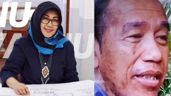 Dr Tifa Ternyata Benar, Jokowi Memang Sakit Kulit: 'Saya Ingat Pemimpin ...