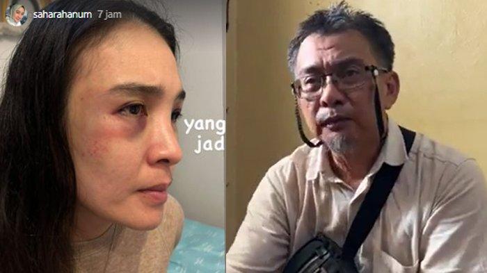 14 Tahun Ibu Muda di Depok Tutupi KDRT, Sang Ayah Baru Tahu Anaknya Disiksa oleh Sosok Tak ...