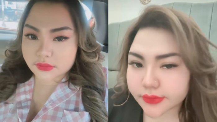 Kondisi Suami Mengenaskan, Lisa Mariana Tak Menyesal Koar-koar Minta ...