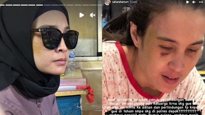 Penyebab Ibu Muda Korban KDRT di Depok Jadi Tersangka, Suami Ngaku Luka Gara-gara Celananya ...