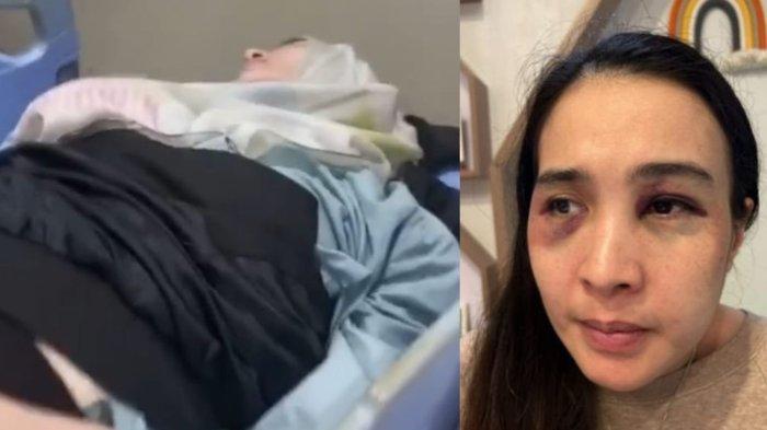 Penderitaan Putri Balqis Ibu Muda di Depok Alami KDRT Belasan Tahun, Malah Dipaksa Damai Oleh ...