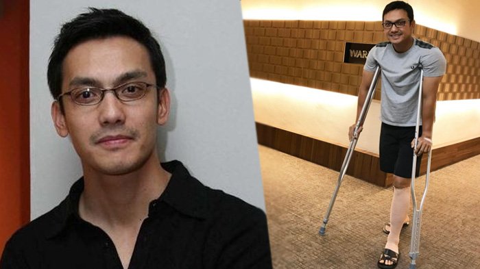 Lama Tak Muncul di Layar Kaca, Begini Kondisi Gunawan Sekarang, Netizen: Sedih Lihatnya Jadi ...