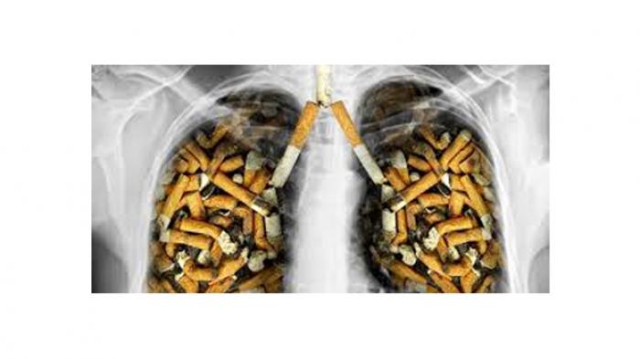 Tips Cara Cepat Detoks Paru-paru Perokok Aktif dan Pasif, Butuh Waktu 3 ...