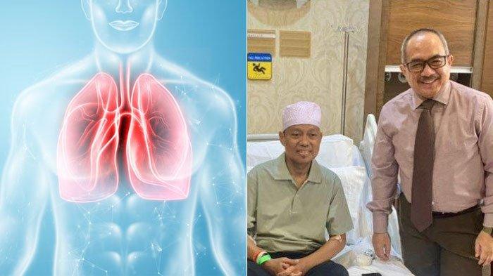 Mengenal Gejala dan Tanda Infeksi Paru-paru yang Dialami Ustaz Das'ad ...