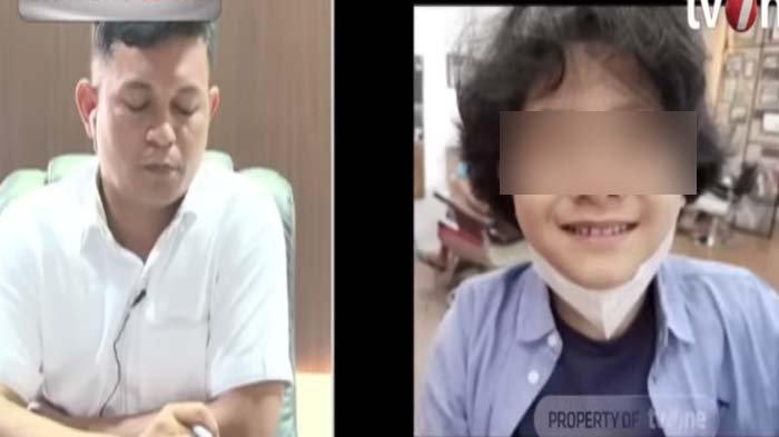 Penyebab Tak Ada yang Lihat Anak Pejabat Kemenhub Tewas dari Lantai 8 ...