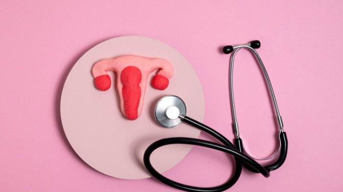 Kenali Perbedaan Kista Ovarium dan Kanker Ovarium, Simak Gejala dan Cara Pengobatannya ...