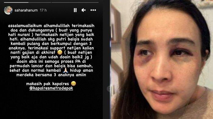 Akhirnya Putri Balqis Ibu Muda Korban KDRT Depok Diperbolehkan Pulang, Adik: Sekarang Berjuang ...