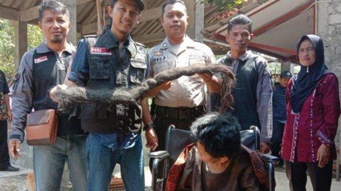 Kisah Sukiyah, 27 Tahun Berambut Gimbal hingga Jadi Sarang Ulat, Kini ...