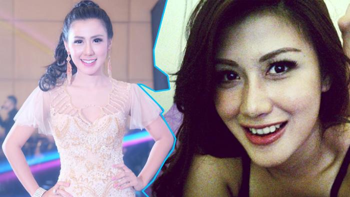 Seperti Ini Bentuk Gigi Rey Utami Sebelum Diubah Jadi Gigi Kelinci ...