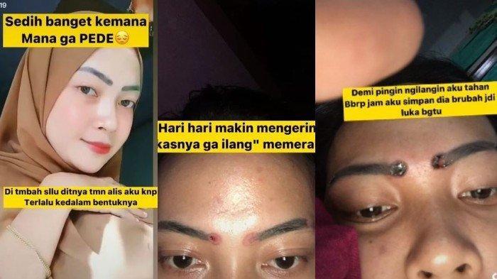 Niatnya Ingin Jadi Cantik, Wanita Ini Sulam Alis, Hasilnya Mengecewakan ...