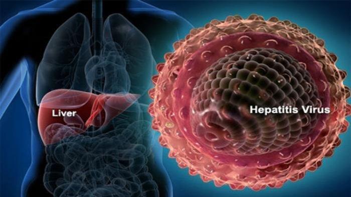 Mengenal Hepatitis, Gejala dan Dampaknya: Ancaman Peradangan Hati yang ...