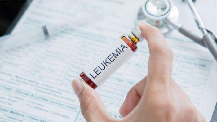Mengenal Leukemia, Gejala dan Pengobatannya - tribungayo.com