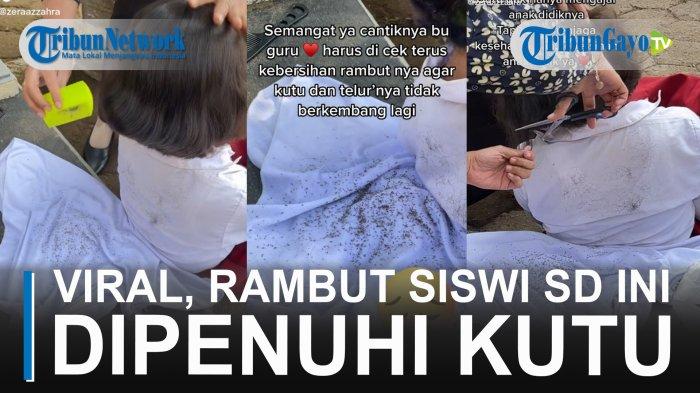 VIDEO Viral di Media Sosial Rambut Seorang Siswi Dipenuhi Kutu ...