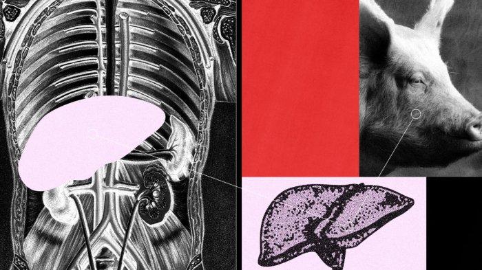 Transplantasi Hati Babi ke Manusia Berfungsi Normal Selama 72 Jam ...